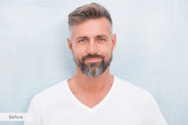Remove Beard from Photo Online [FREE]