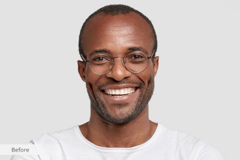 Add Hair to Bald Picture App for Android and iOS