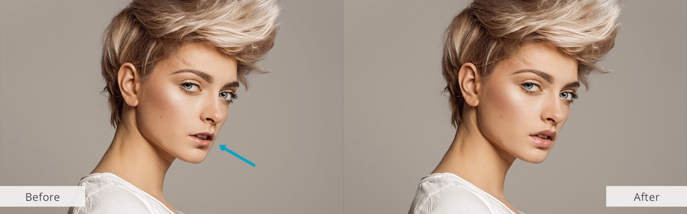 Lip Filler App for Android and iOS