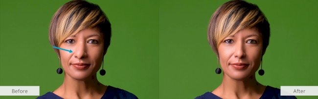 Nose Editor Online: Make a Nose Smaller in 1 Click